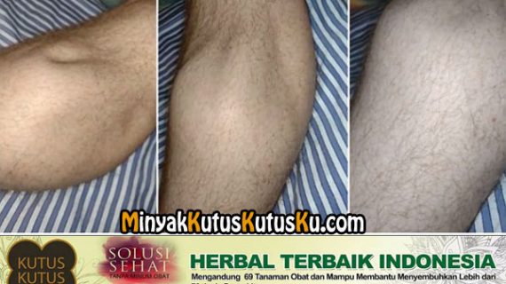 Cara Mengatasi Kram Pada Betis Saat Tidur 0812 5227 0011